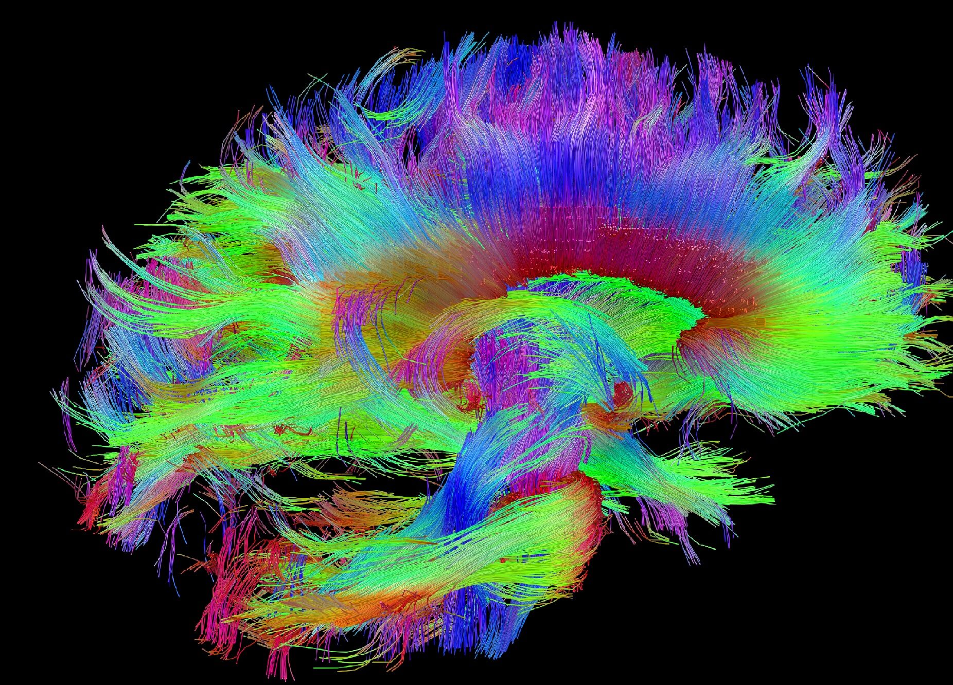 white-matter-fibers-hcp-dataset-red-corpus-callosum – 生醫觀點BioMed｜關注生醫 分享觀點