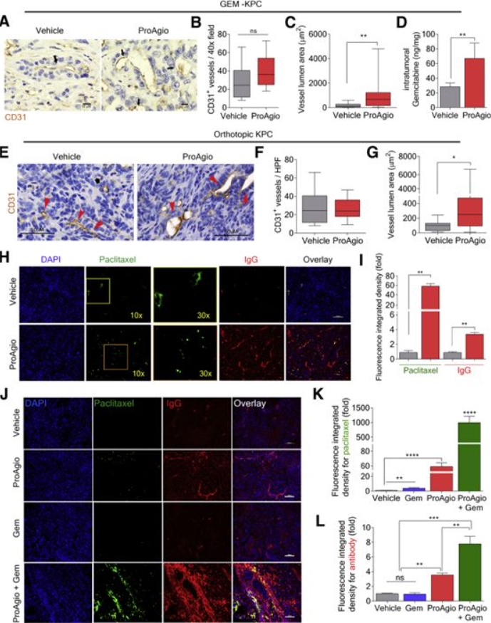 CMGH研究：ProAgio藥物可望預防乳腺癌及胰腺癌 – 生醫觀點BioMed｜關注生醫 分享觀點